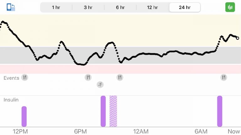 Dexcom G6 - Diabetesnet.com