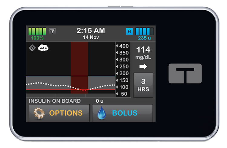 Explore the Top Automated Insulin Delivery Systems for Diabetes ...