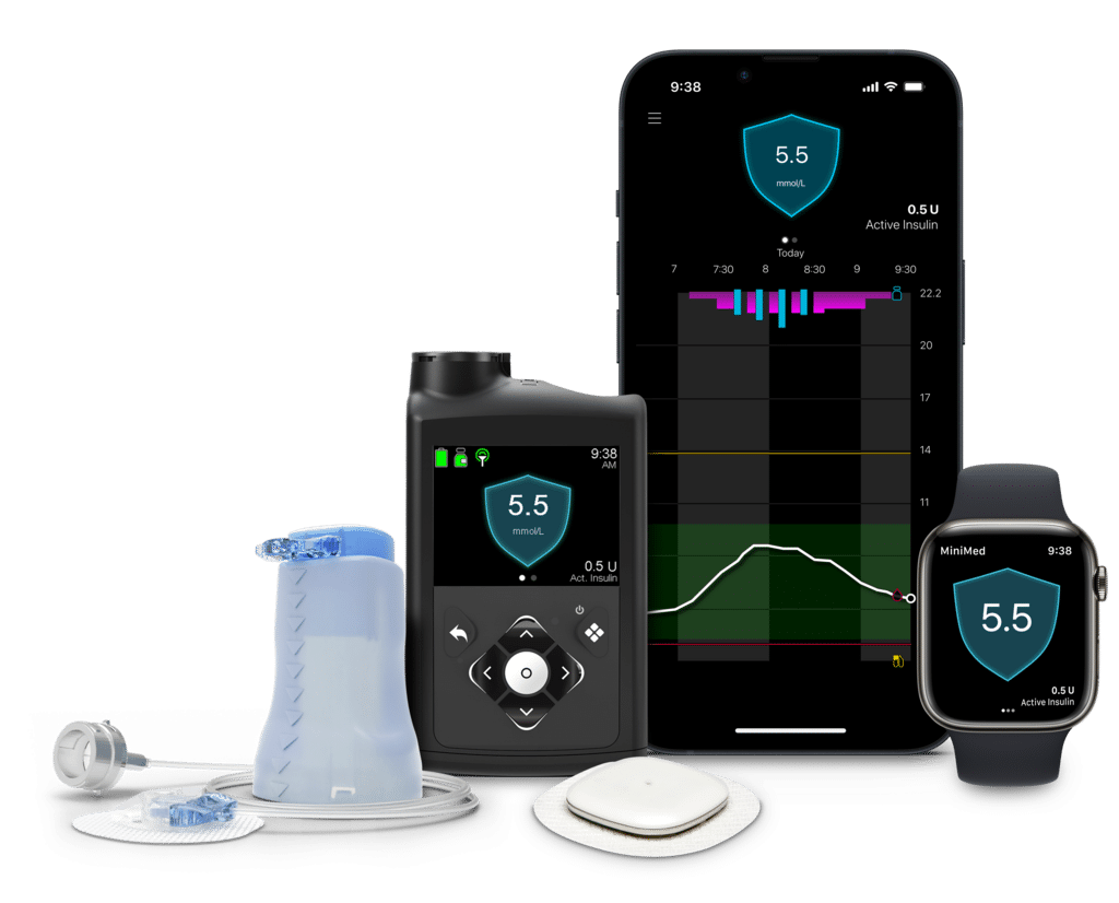 Continuous Glucose Monitor - What is it and how does it work ...