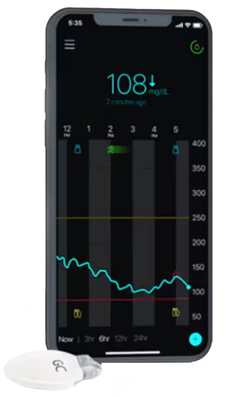 Exploring the Medtronic Guardian Connect and Simplera CGMs ...